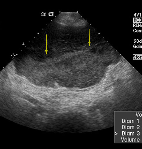 Male Pelvic Ultrasound