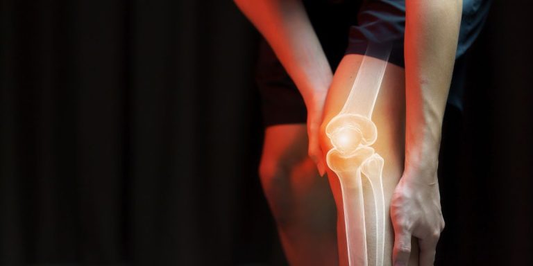 Knee Pain Location Chart - Medex Diagnostic and Treatment Center ...